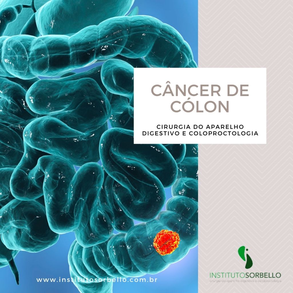 Câncer de cólon